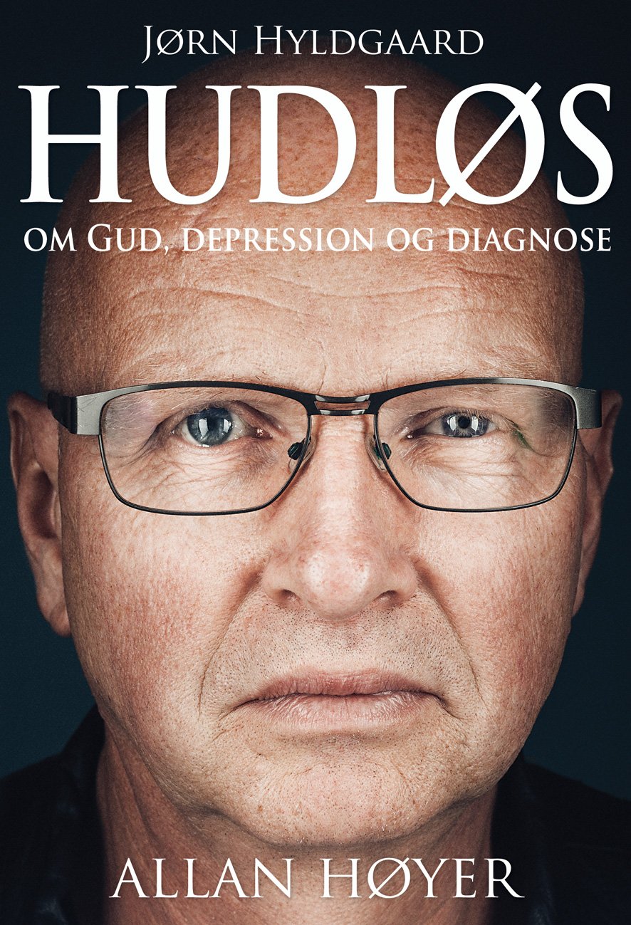Hudløs - Jørn Hyldgaard - Biografier - ProRex Forlag
